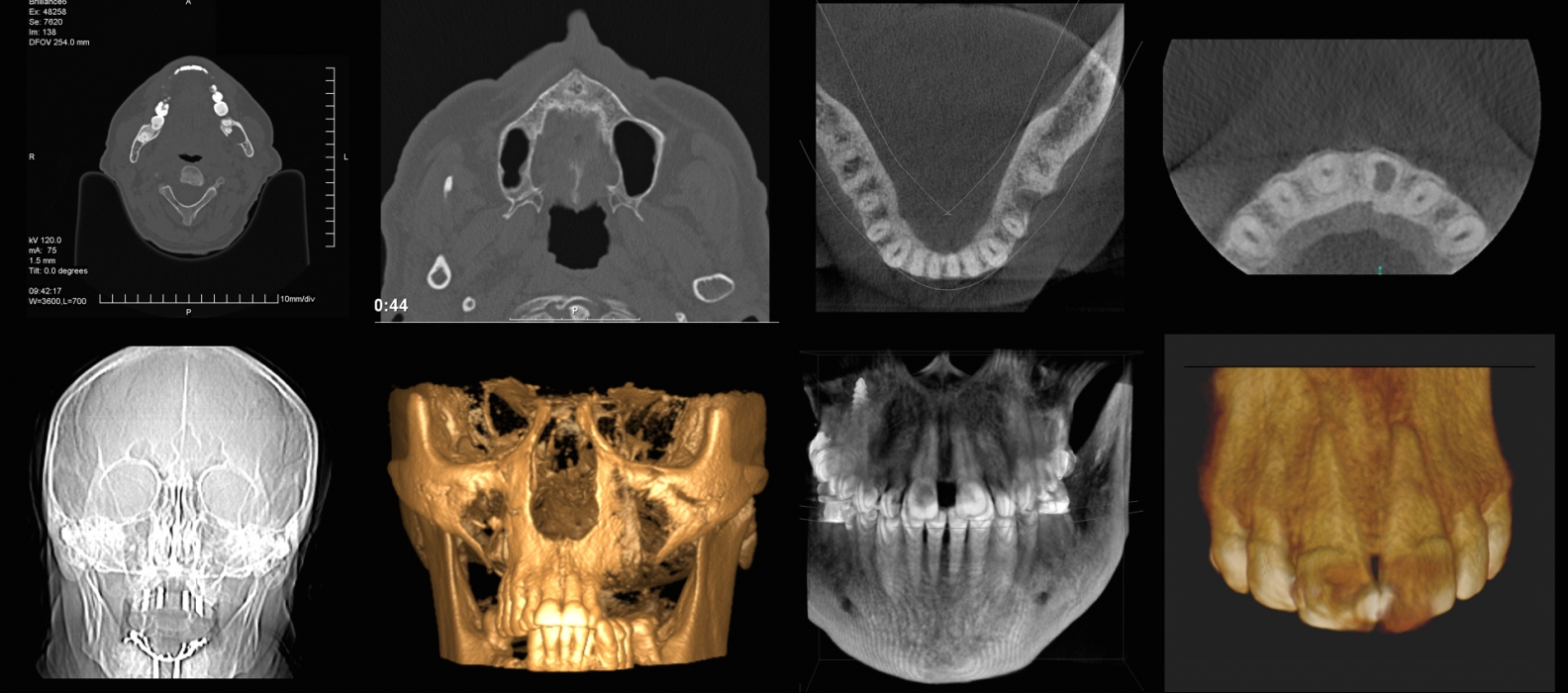 CBCT archivos - Kadi México
